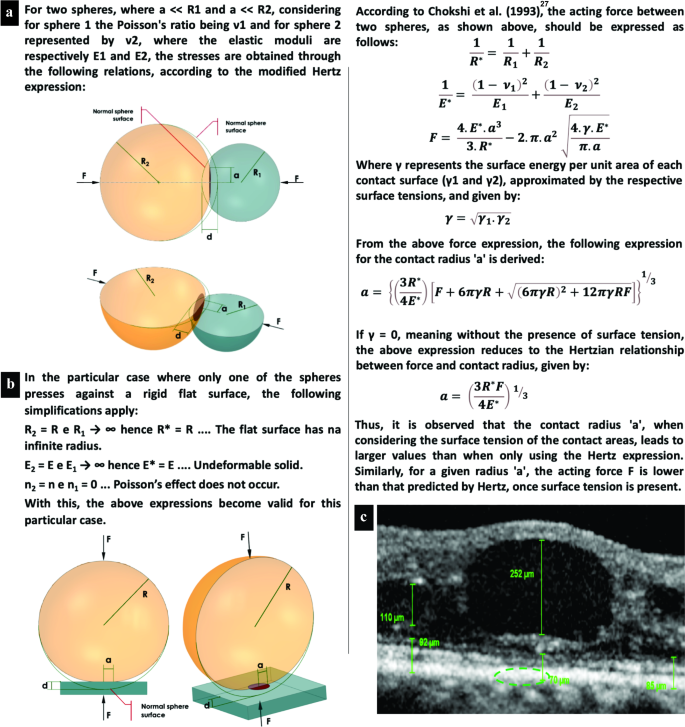 Structural effects of intraretinal cysts on outer retinal layers in ...